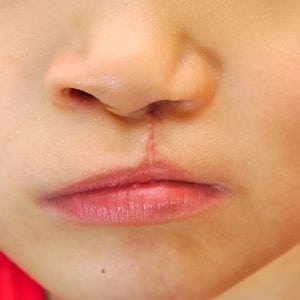 See Our Cosmetic Surgery Procedures | Tristan de Chalain